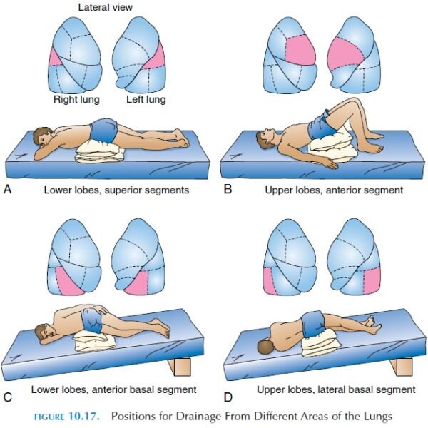 Tapotement Massage for Lungs: Boost Respiratory Health Today - Body ...
